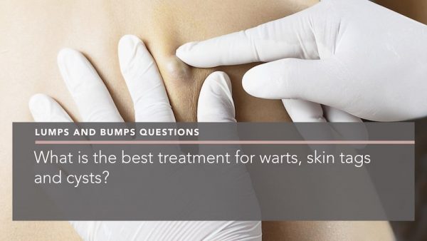 What causes warts, skin tags and cysts? - Penelope Pratsou | Reading ...