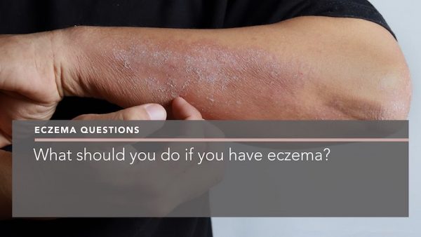 How long does eczema treatment take and what does eczema treatment cost ...